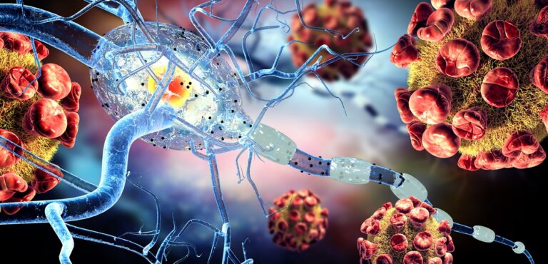 Verlaufsformen der MS - RRMS, SPMS, PPMS, PRMS, RMS & CIS